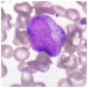 @Nãotemmaisfim@: Promielócitos